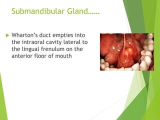 salivary gland investigation and management.ppt