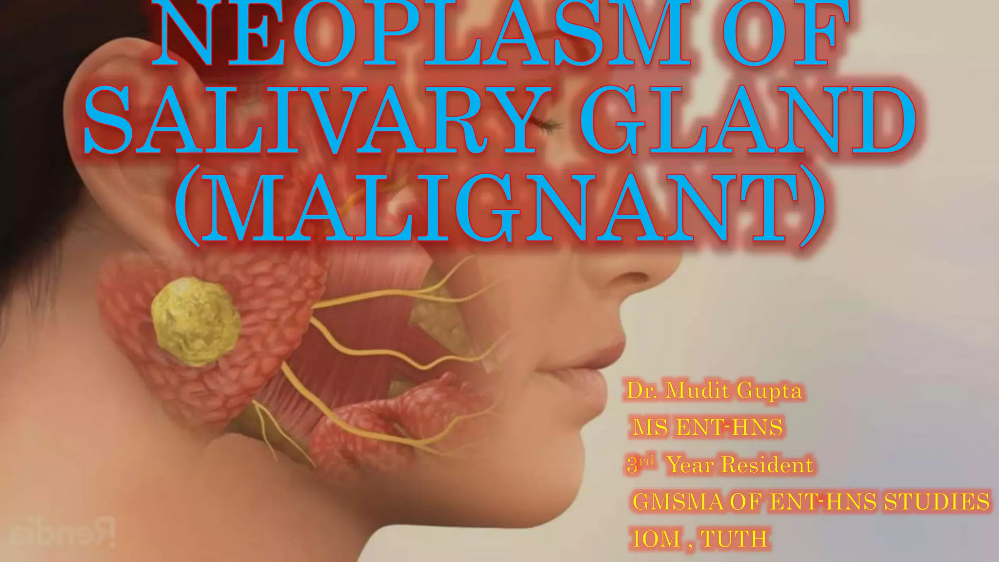 Malignant Salivary gland neoplasm - Dr. Mudit Gupta | PPT