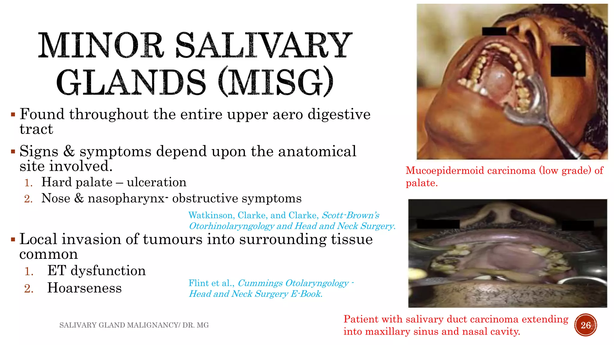 Malignant Salivary gland neoplasm - Dr. Mudit Gupta | PPTX