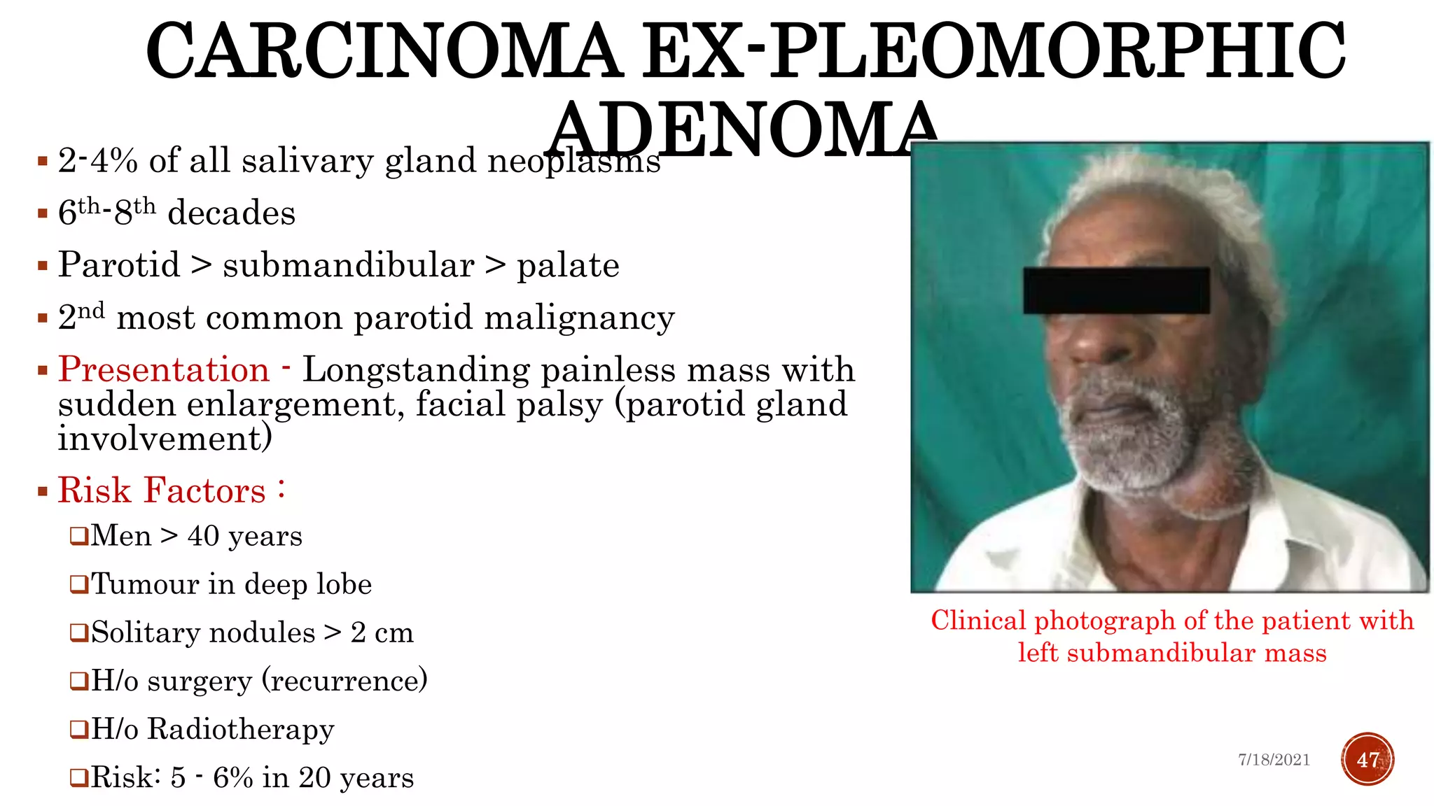 Malignant Salivary gland neoplasm - Dr. Mudit Gupta | PPTX
