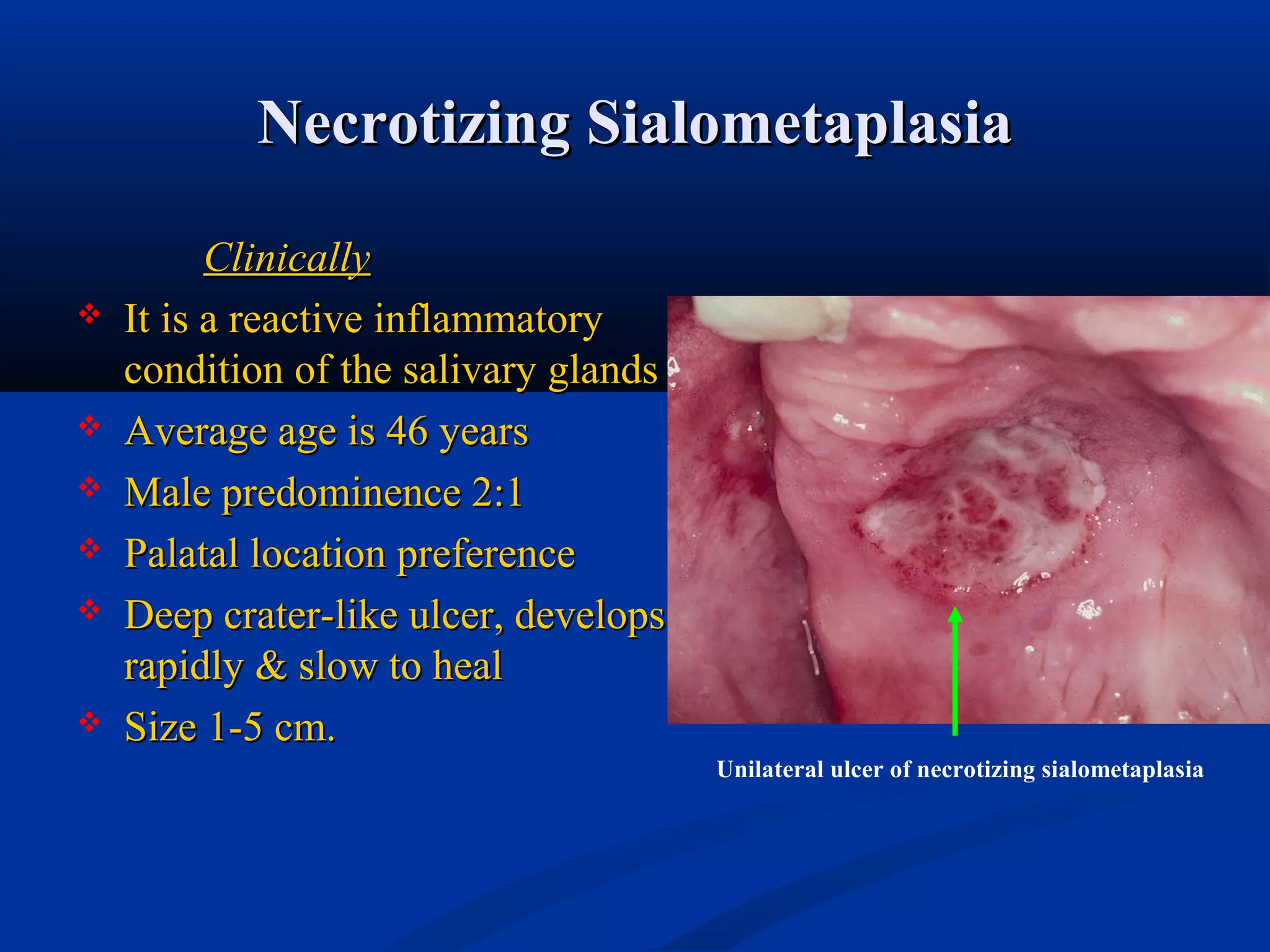 Salivary gland pathology | PPT