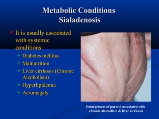 Parotid Gland Swelling Alcohol