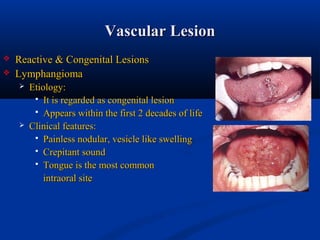 Salivary gland pathology | PPT