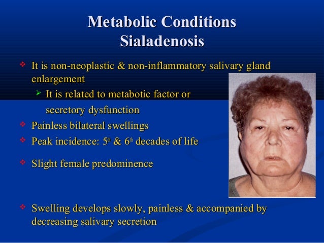Salivary gland pathology