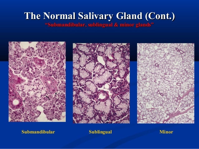 Salivary gland pathology