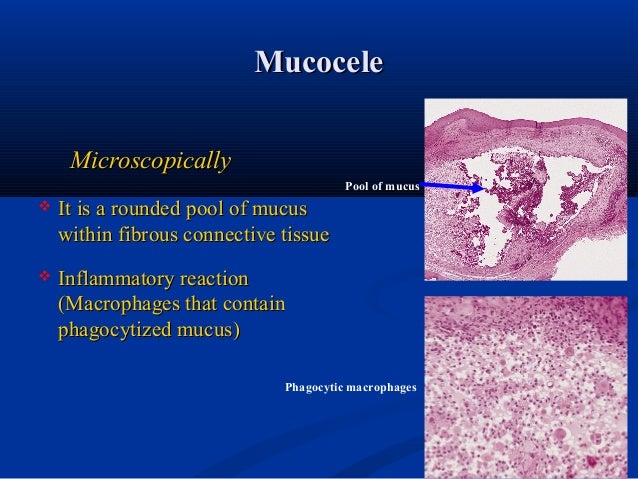 Salivary gland pathology