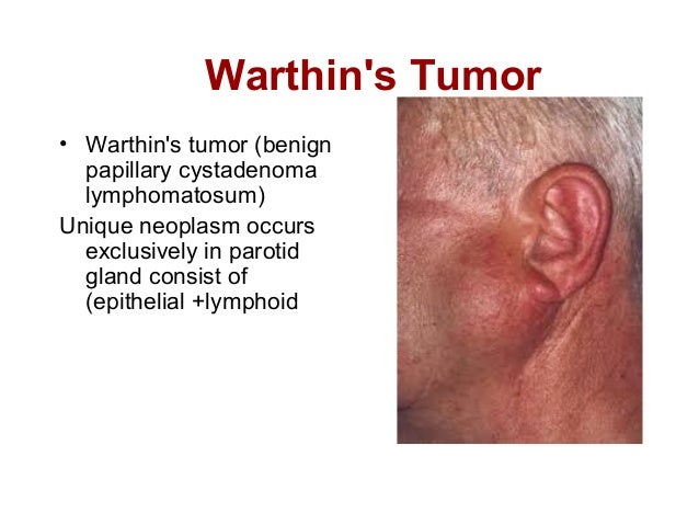 Salivary gland pathology
