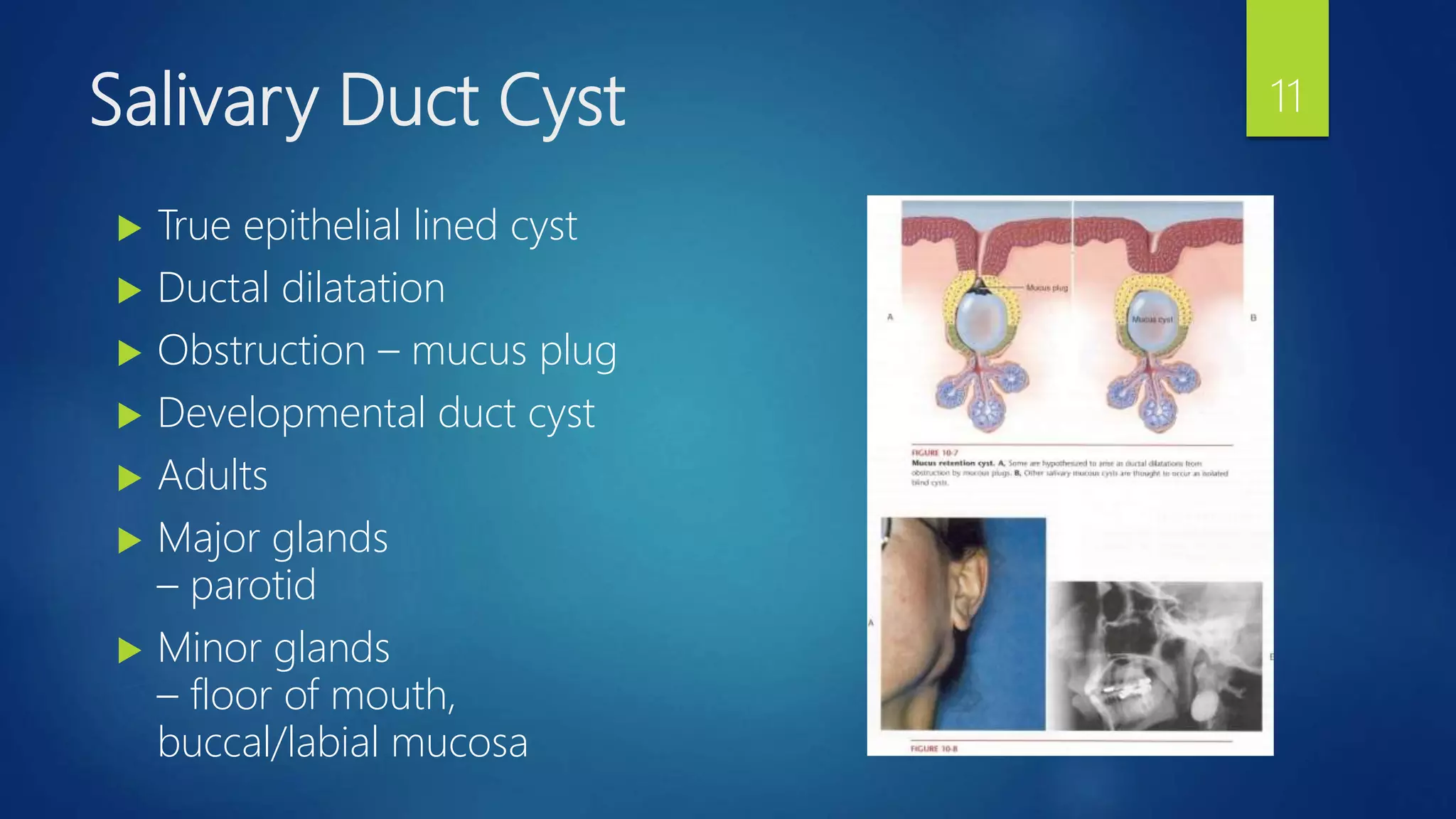 Salivary gland pathology 2 | PPTX
