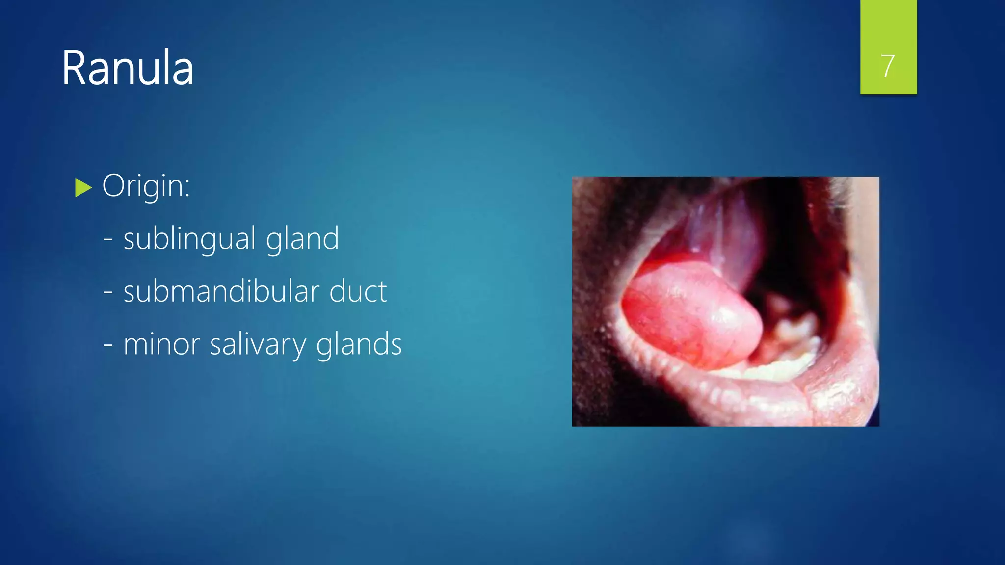 Salivary gland pathology 2 | PPTX | Ear, Nose and Throat Conditions ...
