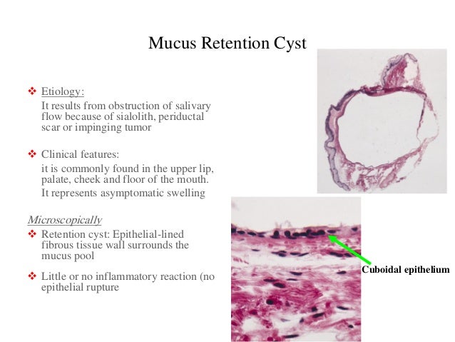 Salivary gland pathoology 1