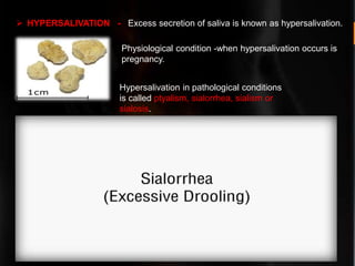 SALIVARY GLAND PPT.pptx