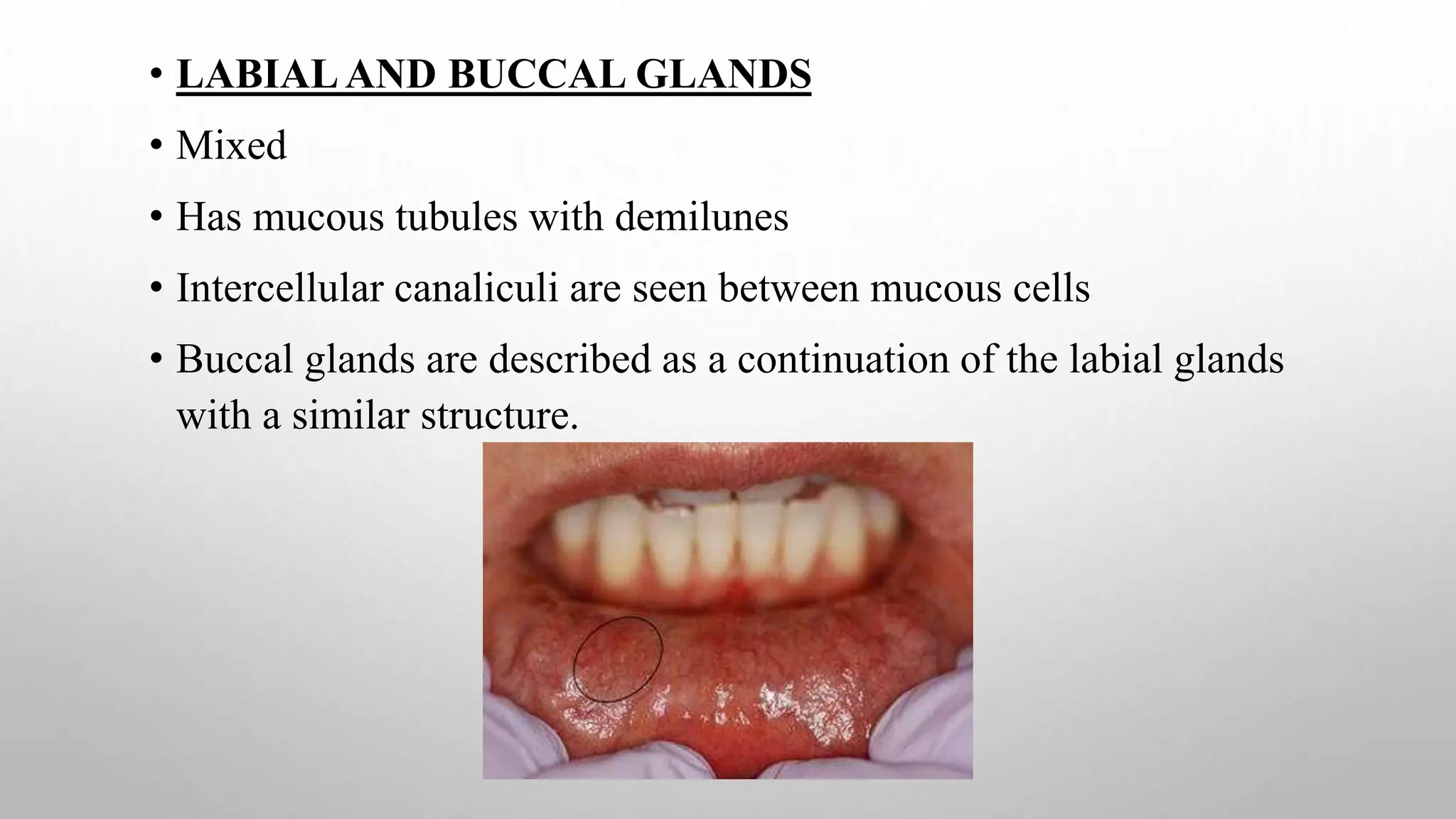 SALIVARY GLAND, SALIVA, PATHOLOGY OF SALIVA | PPTX