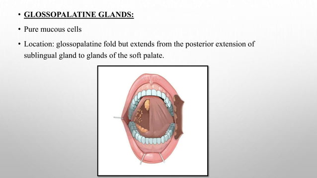 SALIVARY GLAND, SALIVA, PATHOLOGY OF SALIVA | PPT