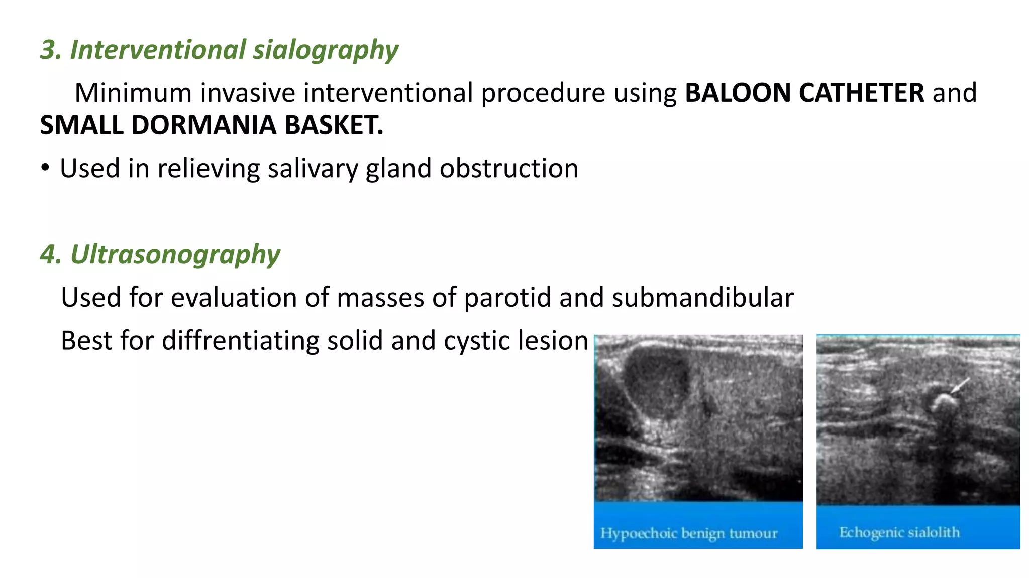 Salivary gland , its disorder and imaging techniques. | PPTX