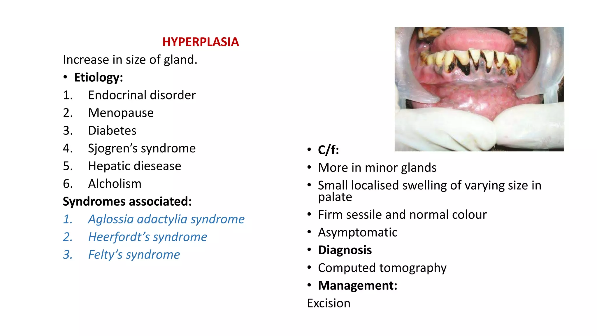 Salivary gland , its disorder and imaging techniques. | PPTX