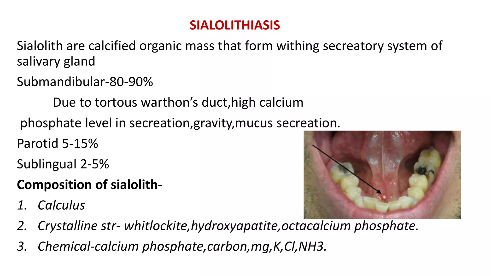 Salivary gland , its disorder and imaging techniques. | PPTX