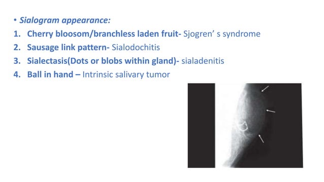 Salivary gland , its disorder and imaging techniques. | PPTX