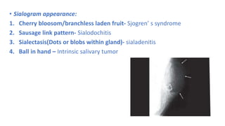 Salivary gland , its disorder and imaging techniques. | PPT