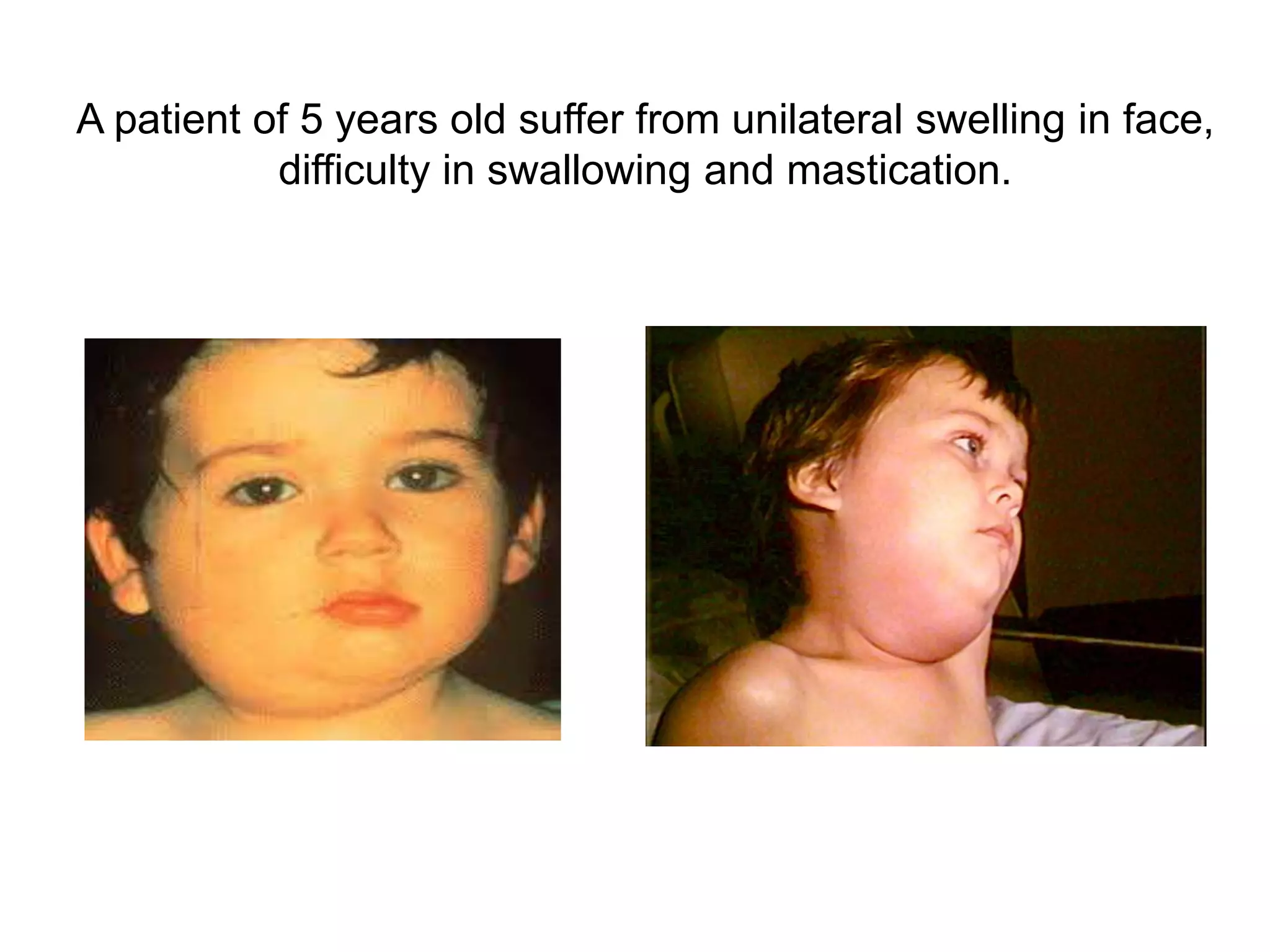 Salivary Gland Quizppt