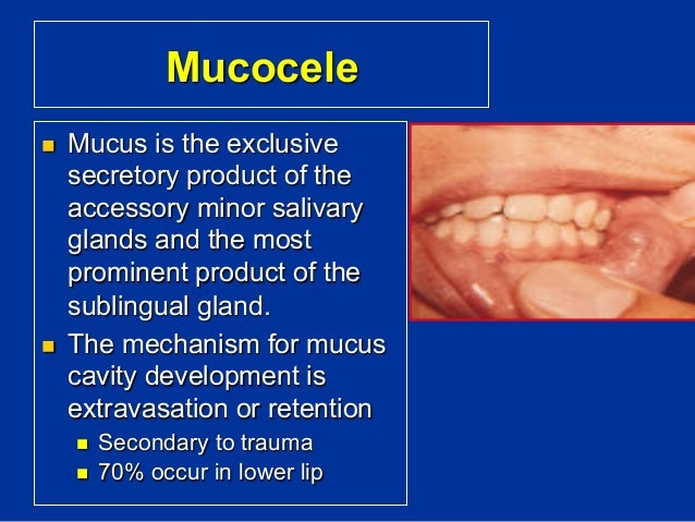 Salivary glands diseases