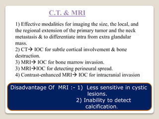 Salivary gland Tumors | PPTX