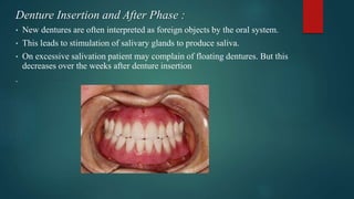 Saliva & Salivary glands A Prosthodontics Perspective | PPTX