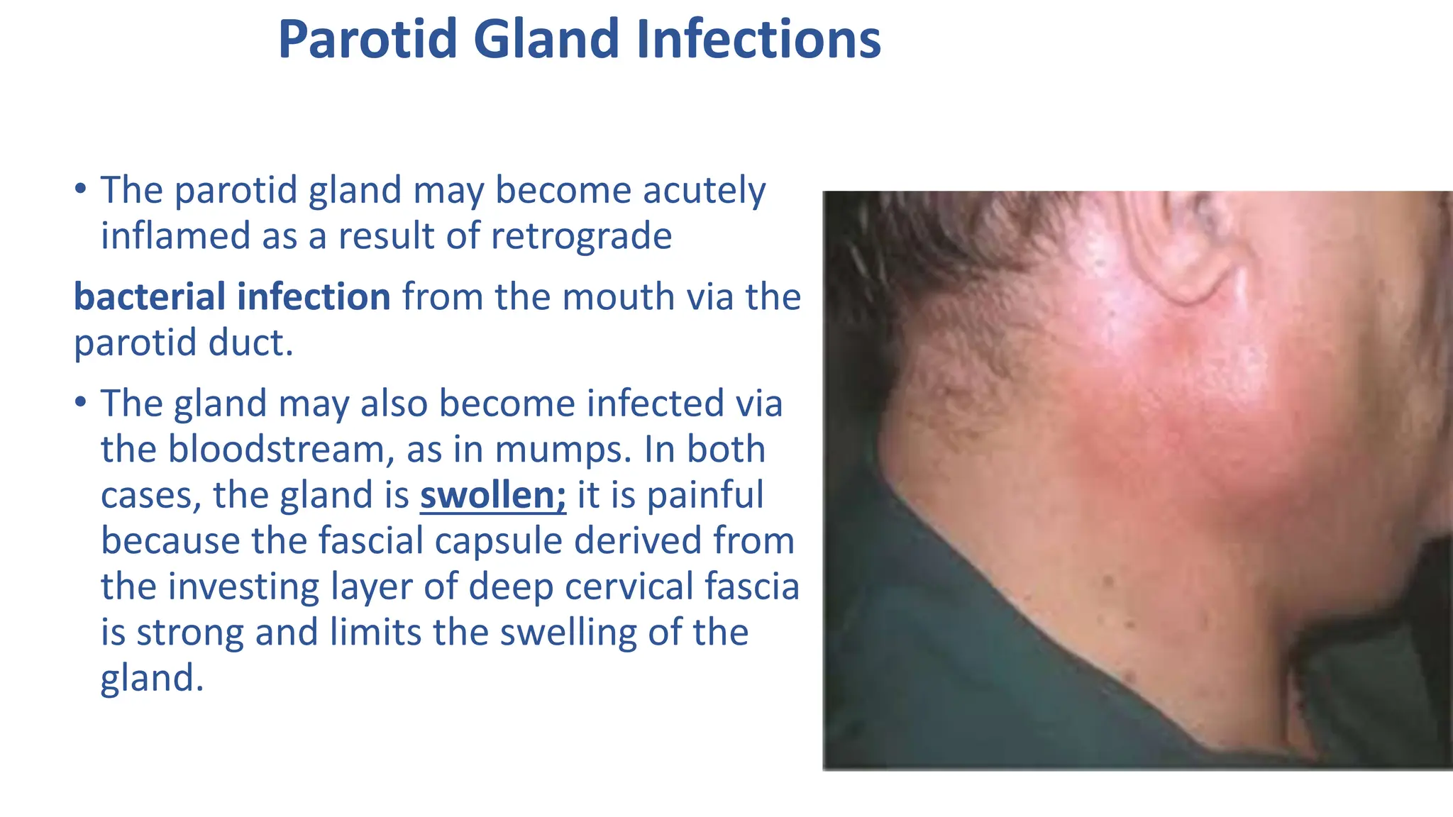 anatomy of the human Salivary Glands.pptx