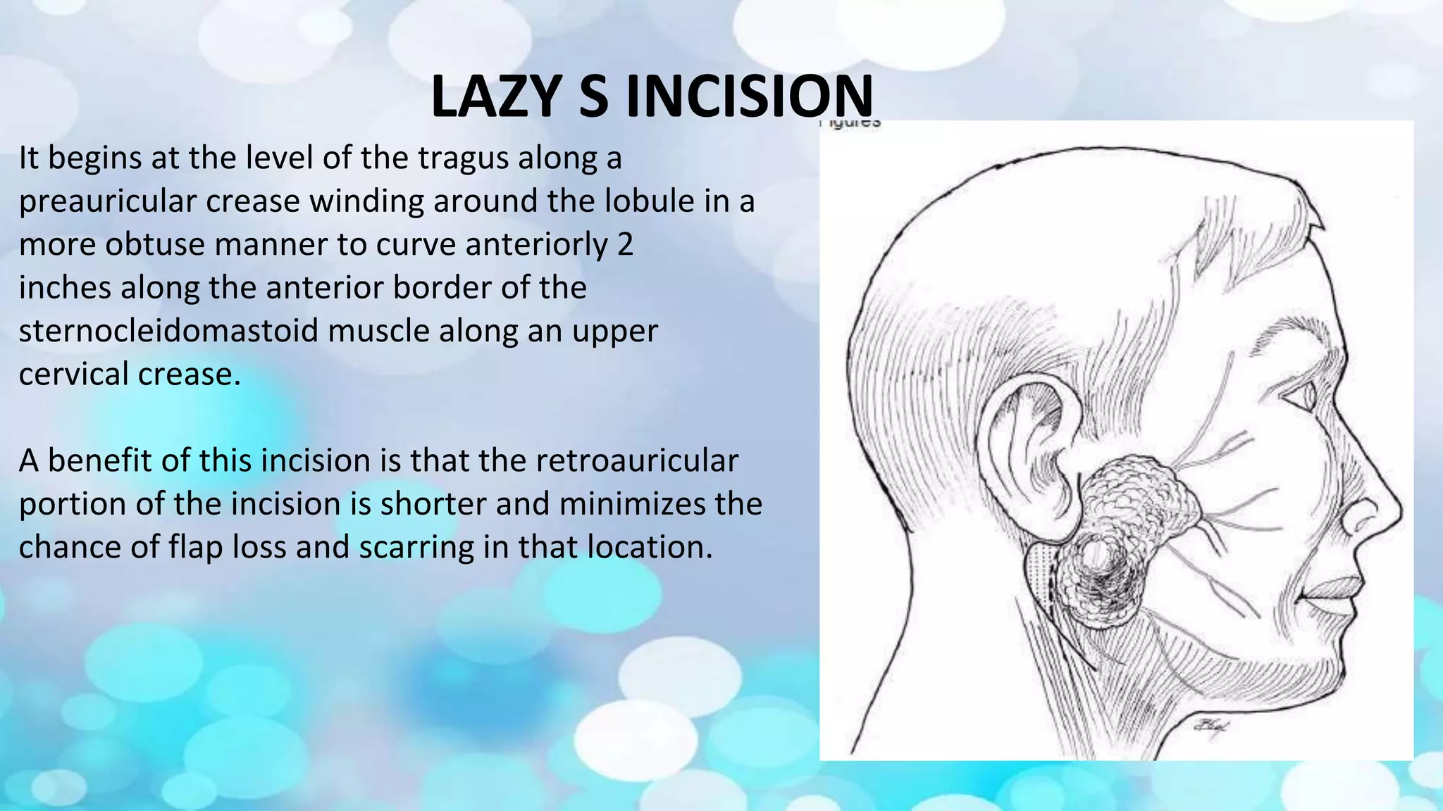 Surgical anatomy of Salivary glands - ORAL AND MAXILLOFACIAL SURGERY | PPTX