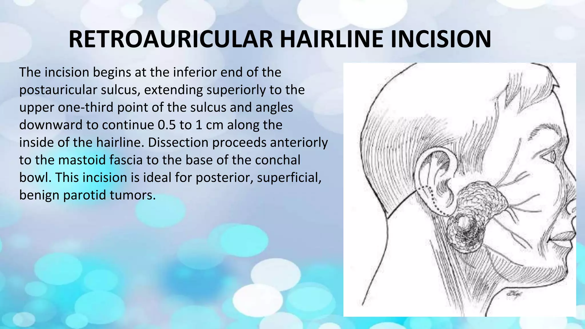 Surgical anatomy of Salivary glands - ORAL AND MAXILLOFACIAL SURGERY | PPTX