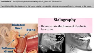 Salivary Glands | PPTX