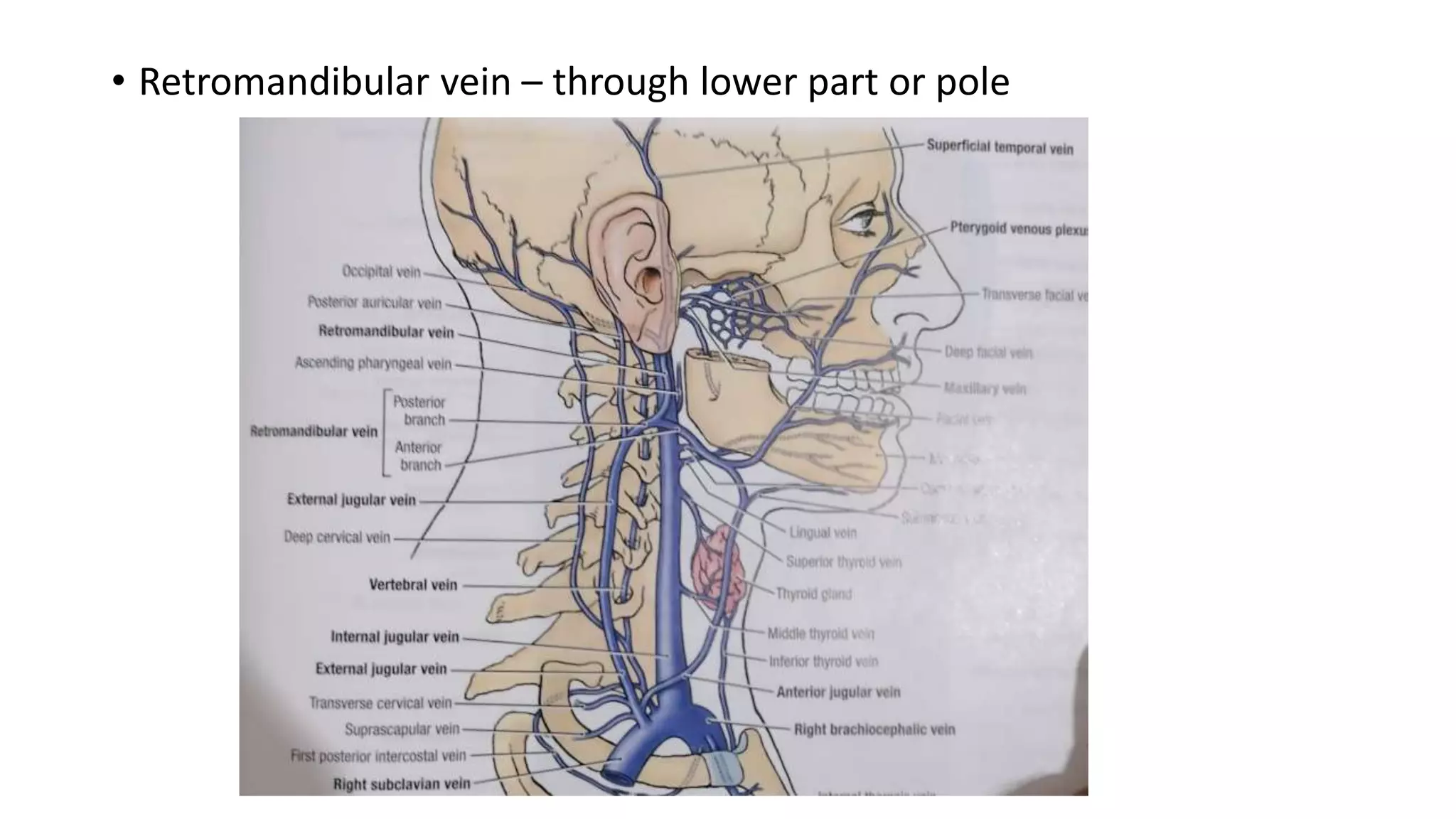 Parotid Salivary glands .pptx