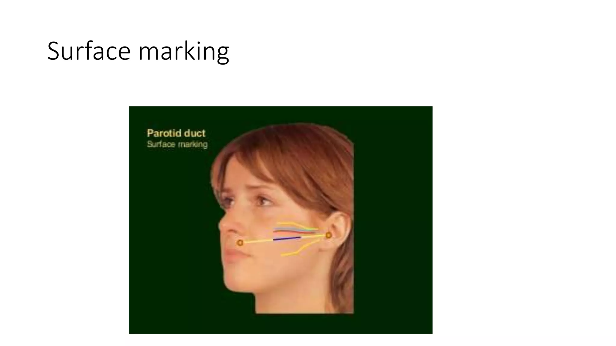 Parotid Salivary glands .pptx