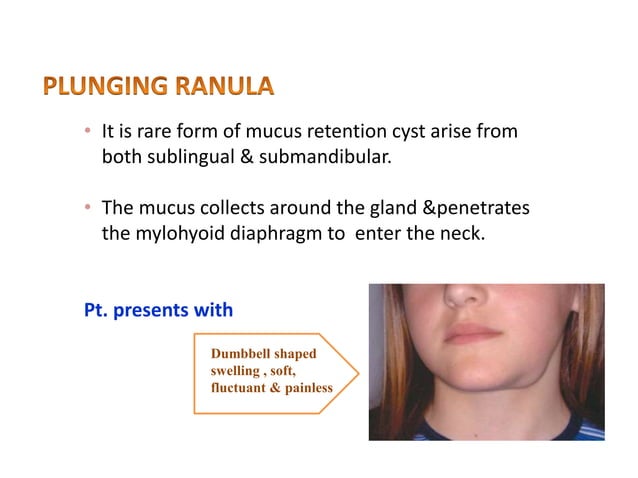 Salivary glands anatomy clinical features and diseases management | PPT