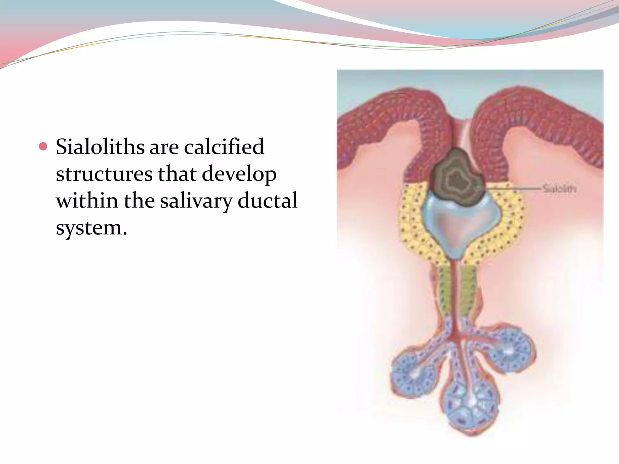 Salivary glands diseases 1 | PPT