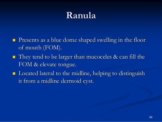 Salivary glands disorders i