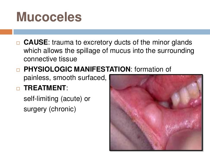Salivary glands finals OHE