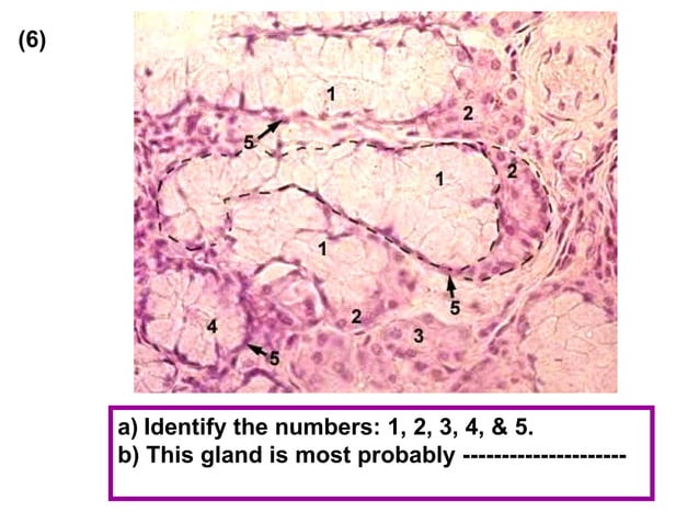 Salivary glands &pancreas | PPT | Endocrine and Metabolic Diseases ...