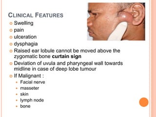 Salivary gland tumor | PPTX