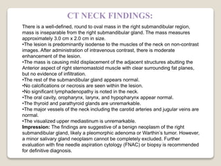 SALIVARY GLAND TUMORS AND THEIR MANAGEMENT.pptx