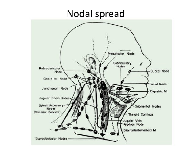 Nasopharyngeal Carcinoma