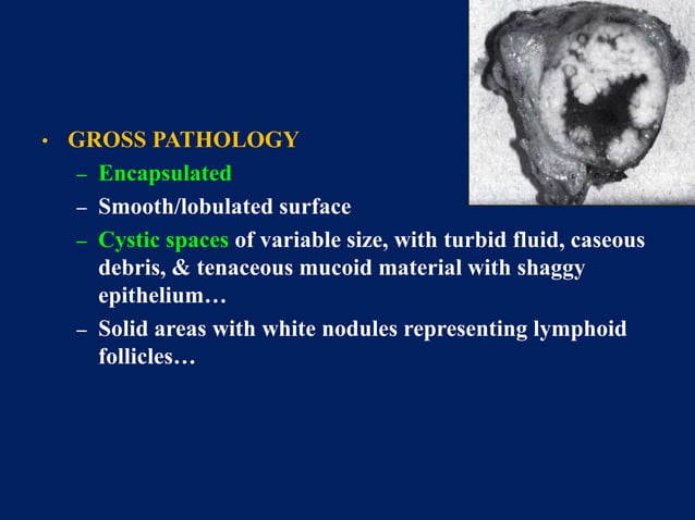 Salivary gland tumors | PPTX | Ear, Nose and Throat Conditions | Diseases and Conditions