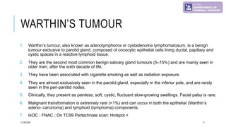 Salivary gland tumours | PPTX