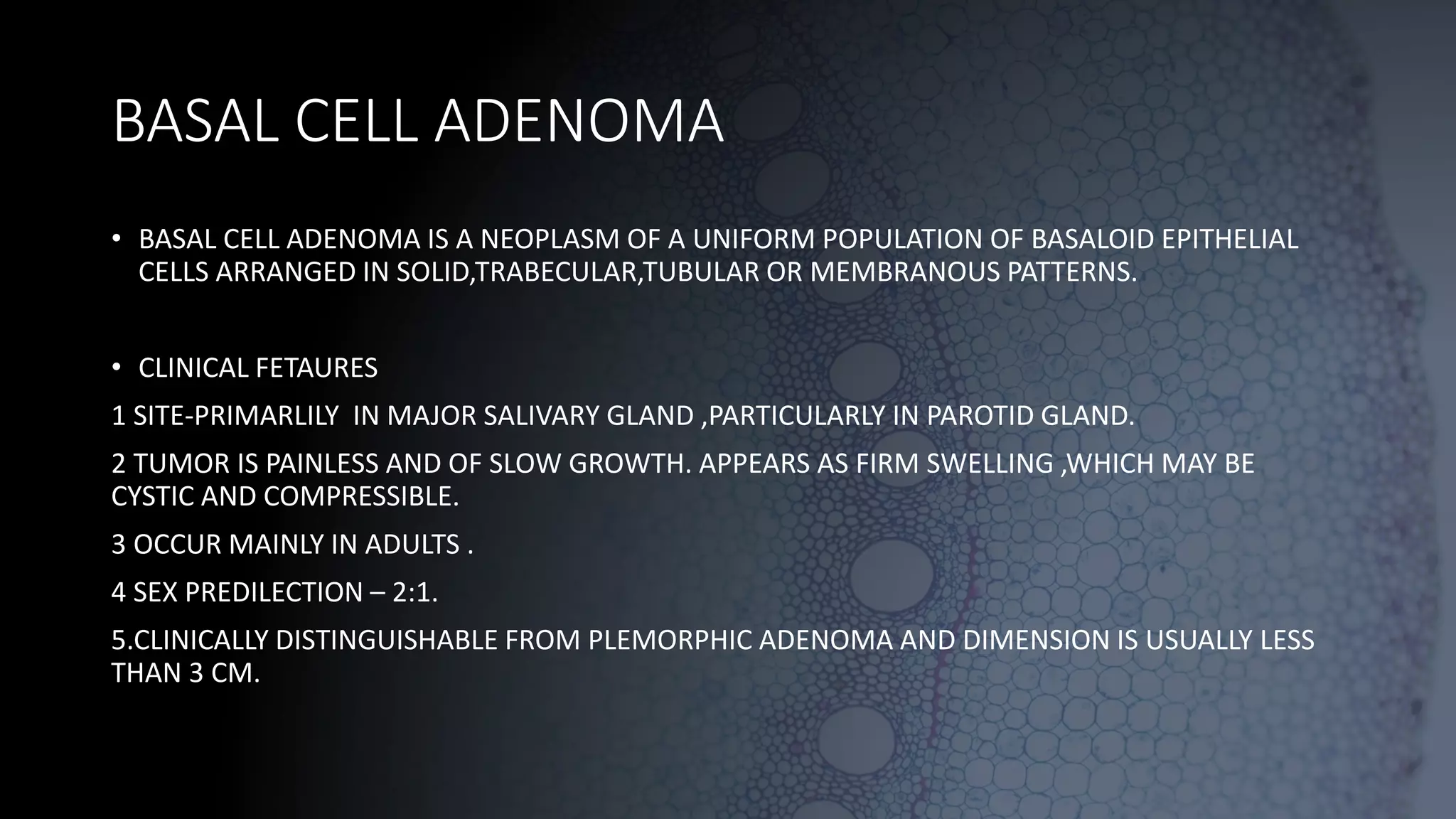 SALIVARY GLAND TUMOURS | PPTX