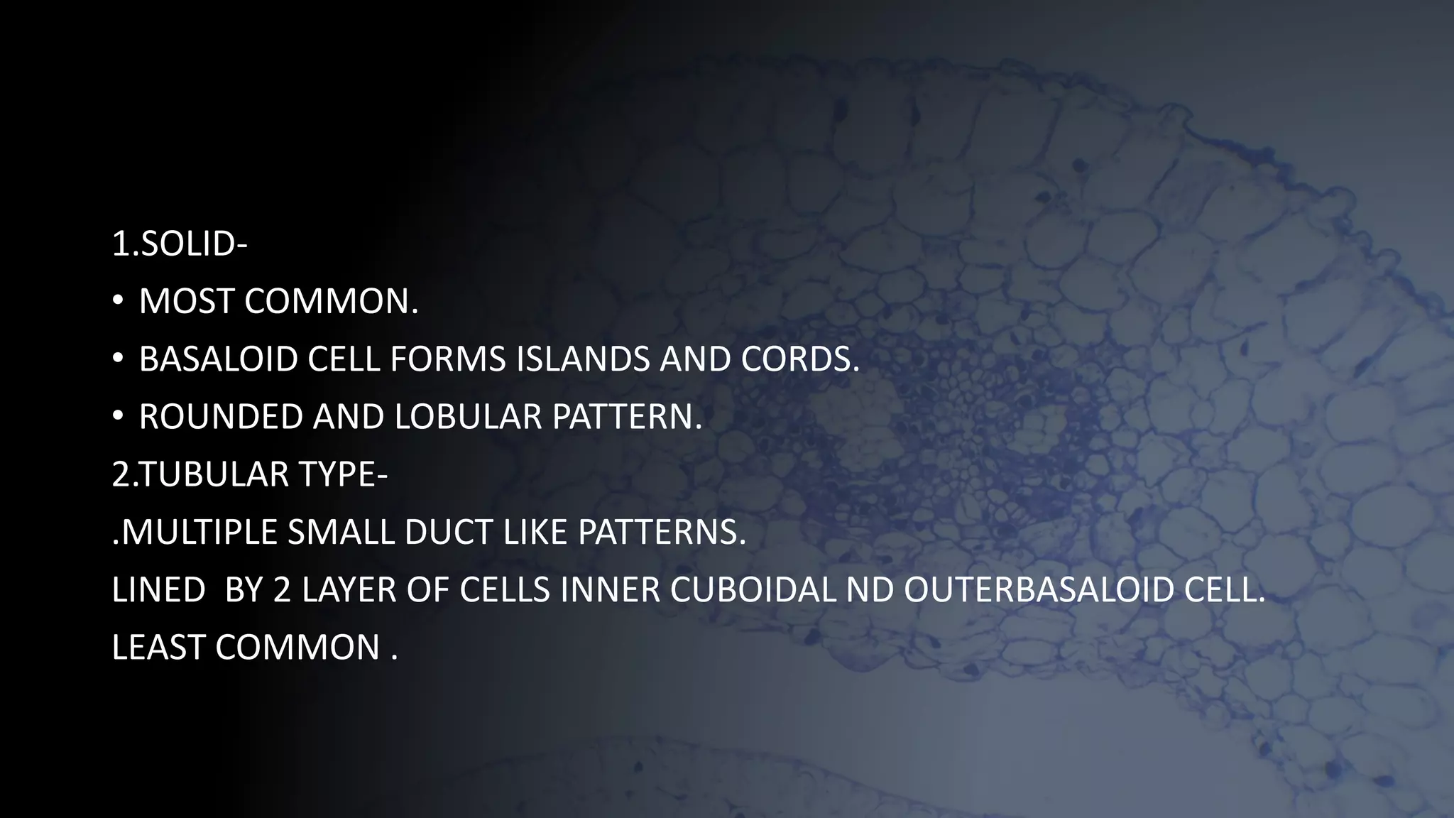 SALIVARY GLAND TUMOURS | PPTX