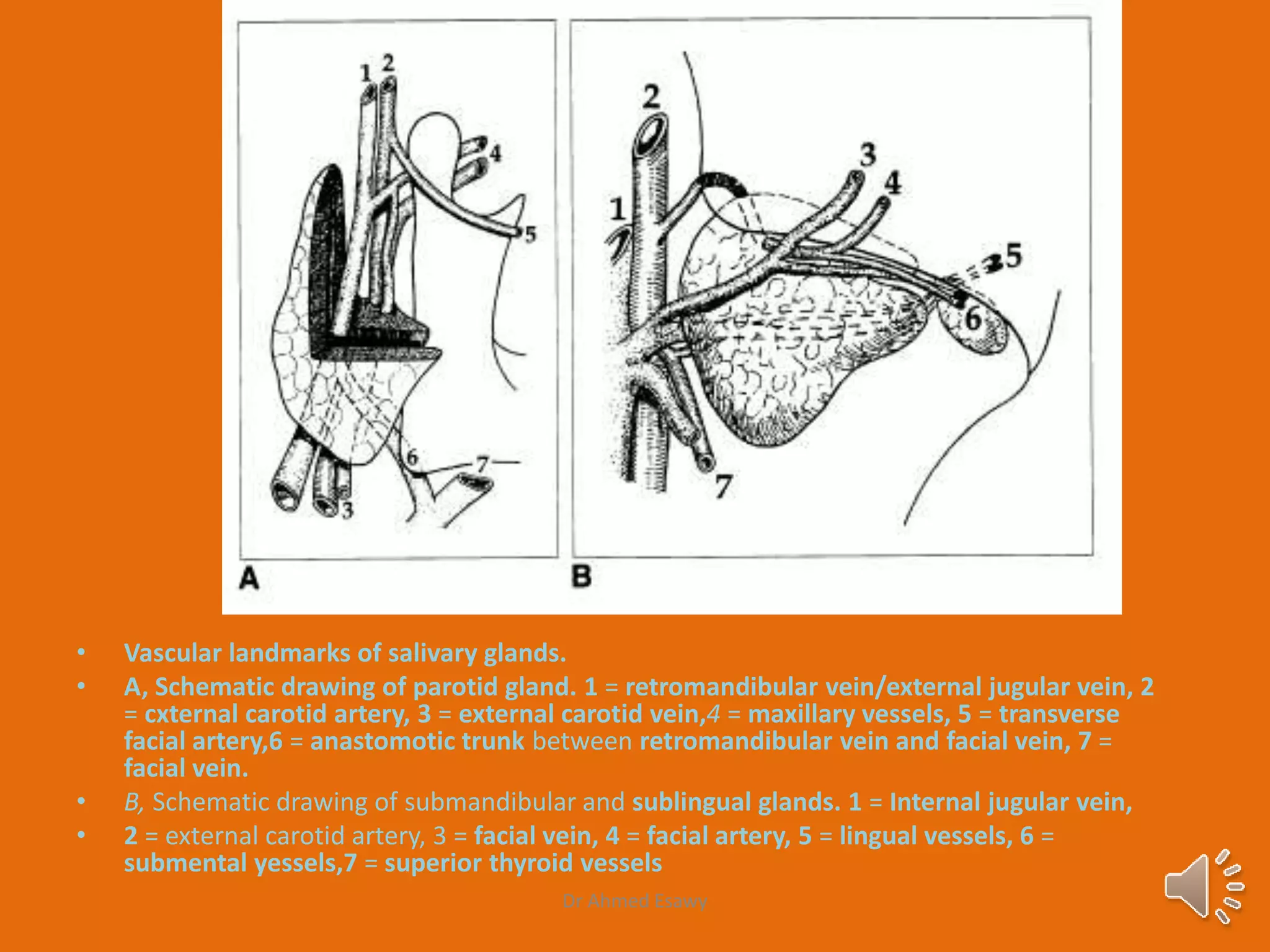 Dr Ahmed Esawy Salivary gland ultrasound | PDF