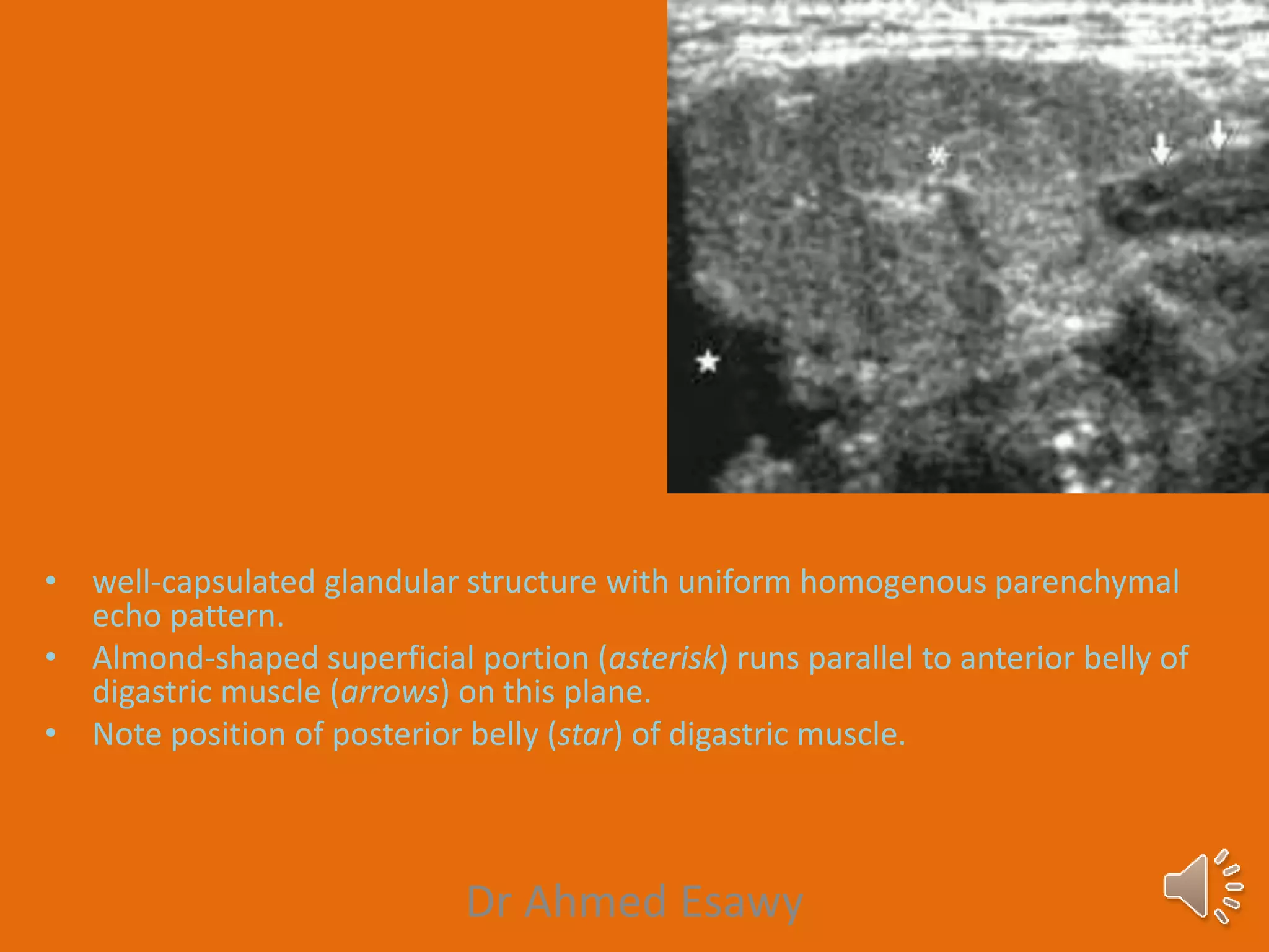 Dr Ahmed Esawy Salivary gland ultrasound | PDF