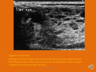 Dr Ahmed Esawy Salivary gland ultrasound | PDF