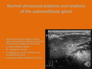 Submandibular Gland Ultrasound