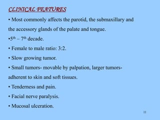 salivary malignancy.ppt