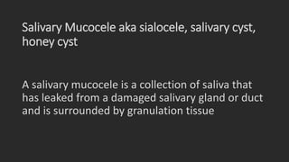 Salivary mucocele | PPTX